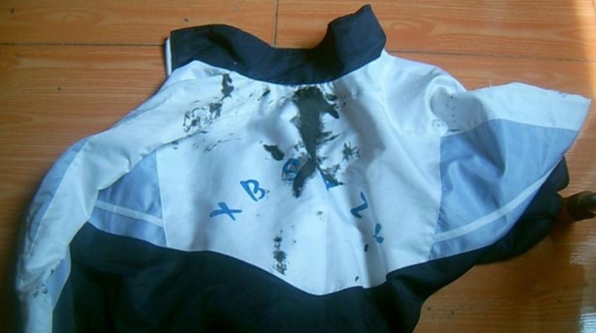 墨汁弄到白色衣服上怎么去除图标