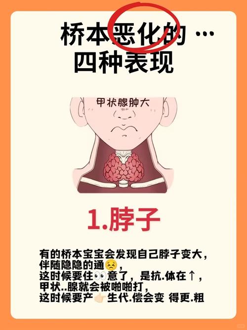 桥本病与甲状腺癌的关系图标