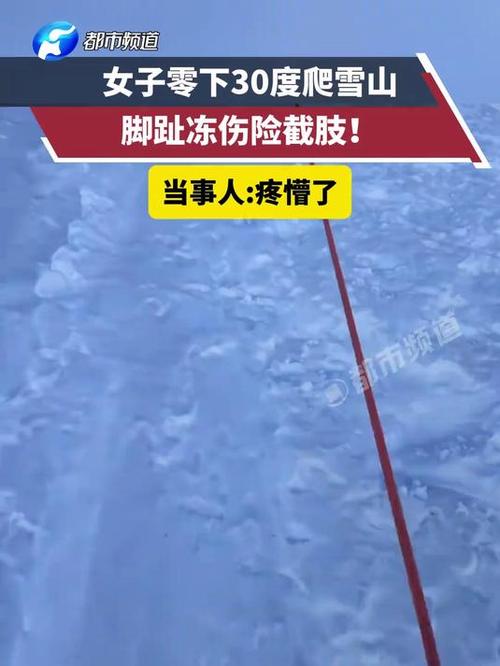 爬雪山后遗症有哪些图标