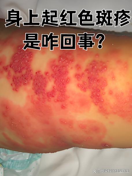 如果是红码怎么办截图