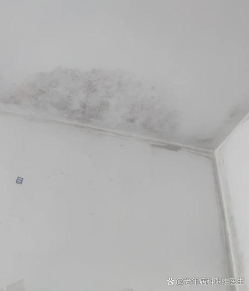 房间有霉味对人有害吗图标