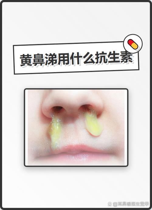 治黄鼻涕最灵三个偏方