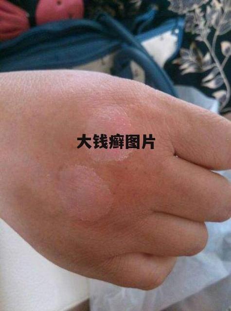 看图识病扫一扫截图
