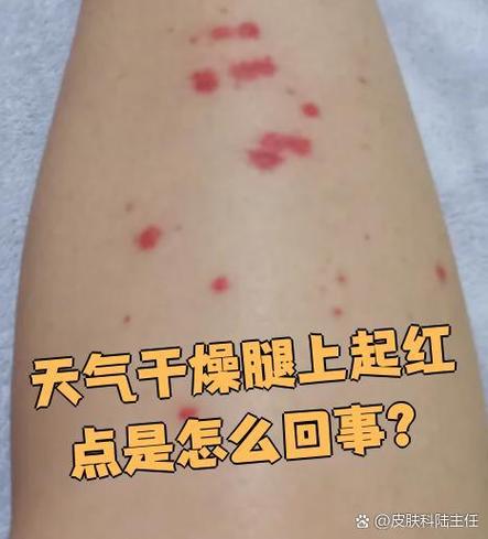 天气红了是什么引起的截图