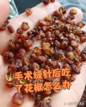 术后可以吃花椒吗图标