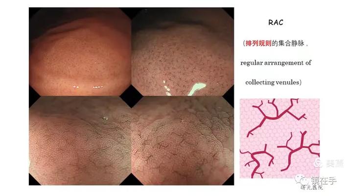 正常人胃凸图片图标
