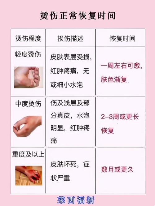 烫伤后怎么处理好的快图标