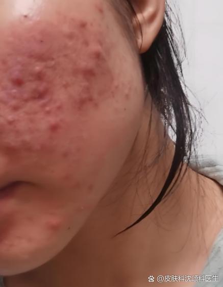 脸上起红包还痒怎么办图标