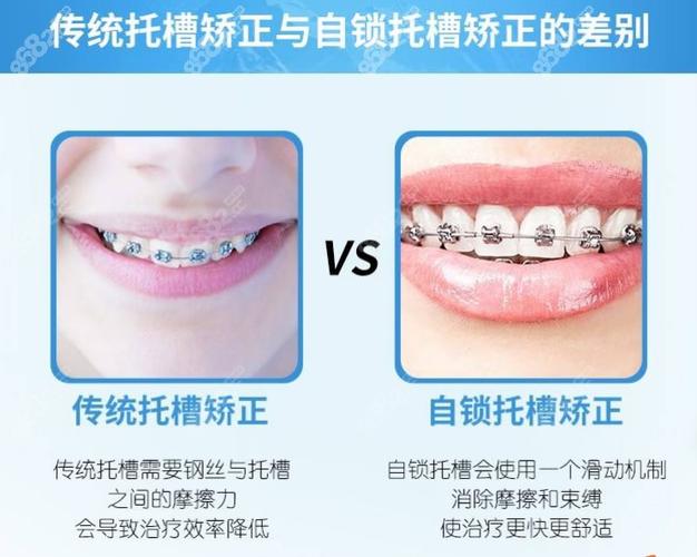 正畸和矫正有什么区别图标