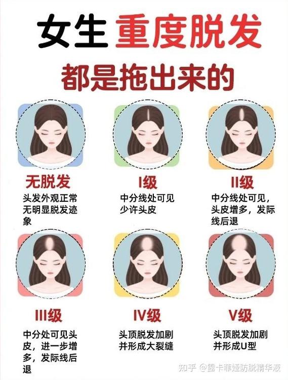 脱发怎么治疗最好图标