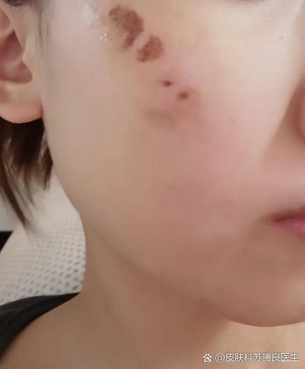 身上沾了不干净人表现图标