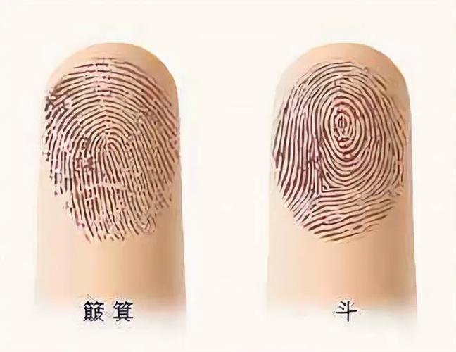 簸箕纹长在手掌上截图