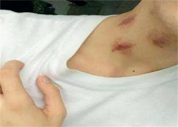 大人知道草莓印吗截图