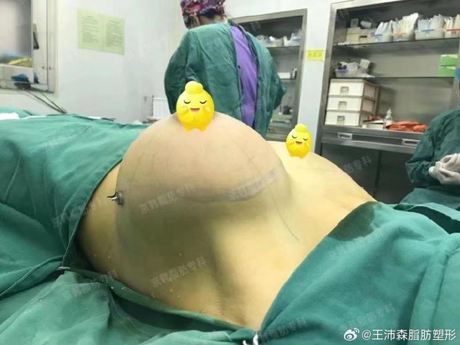 魅力顶峰丰胸广告图标