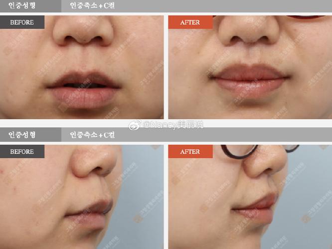 改变脸型最快最有效的方式截图