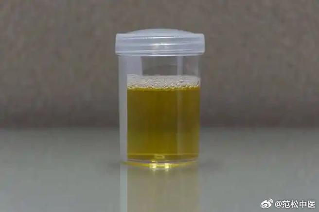 排尿性状是什么截图