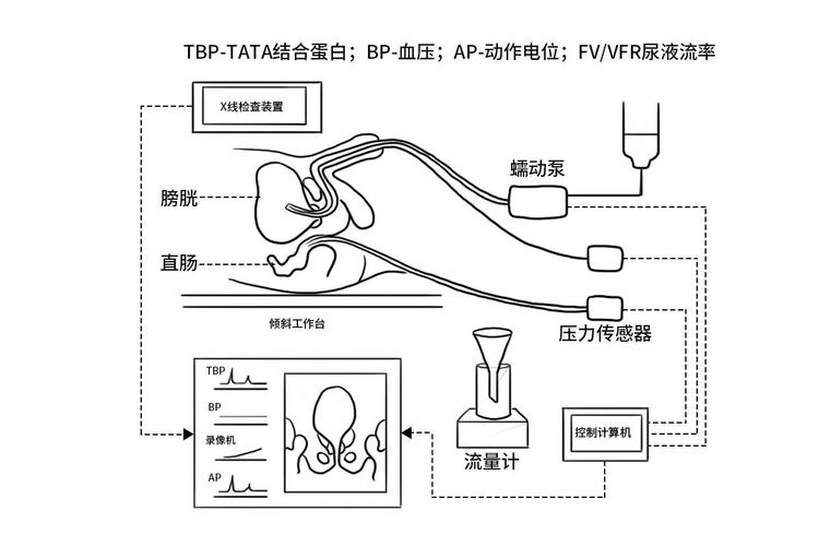男性尿动力检查过程截图