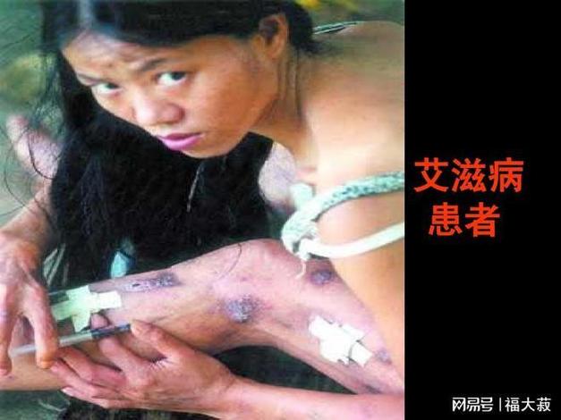 致命的爱滋病图片