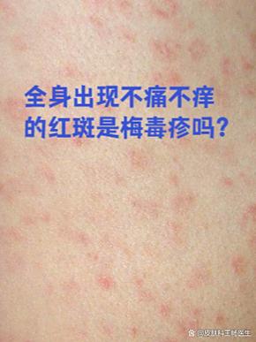 屏幕有红斑是怎么回事图标