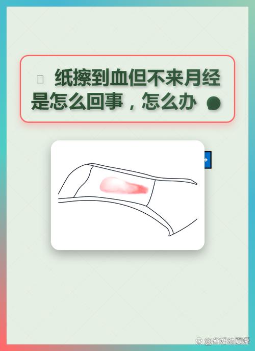 下面用纸擦有血但又没来月经图标