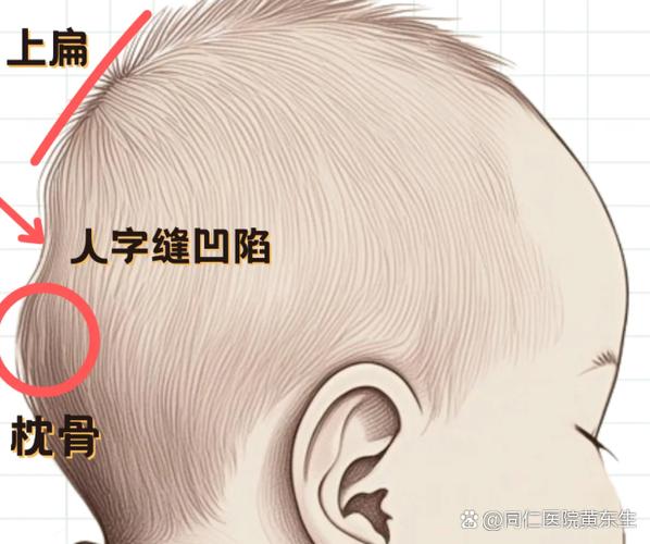 为什么头后面凹了一块截图