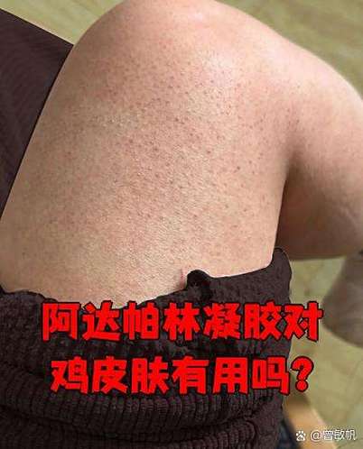 鸡皮肤会伴随一生吗图标