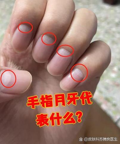 指甲月牙上面包裹的皮图标