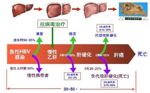 乙肝攻克最新研究消息图标