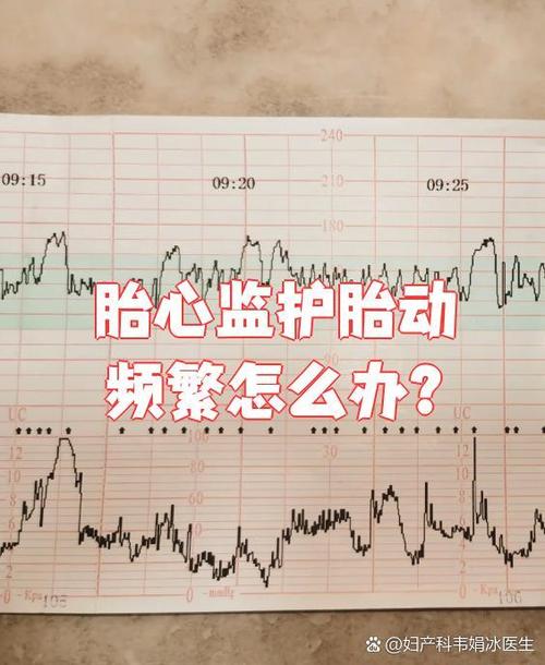 苹果手机测胎心的软件缩略图