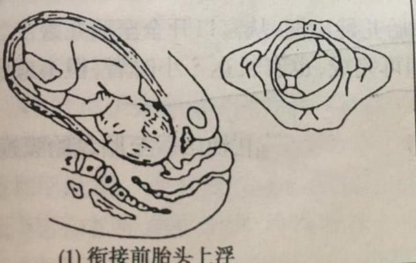 开五指胎头高截图
