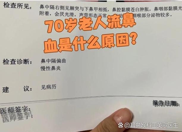 60-70流鼻血是什么原因图标