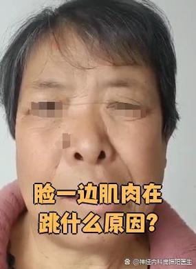 脸部一边肌肉跳是什么事?图标