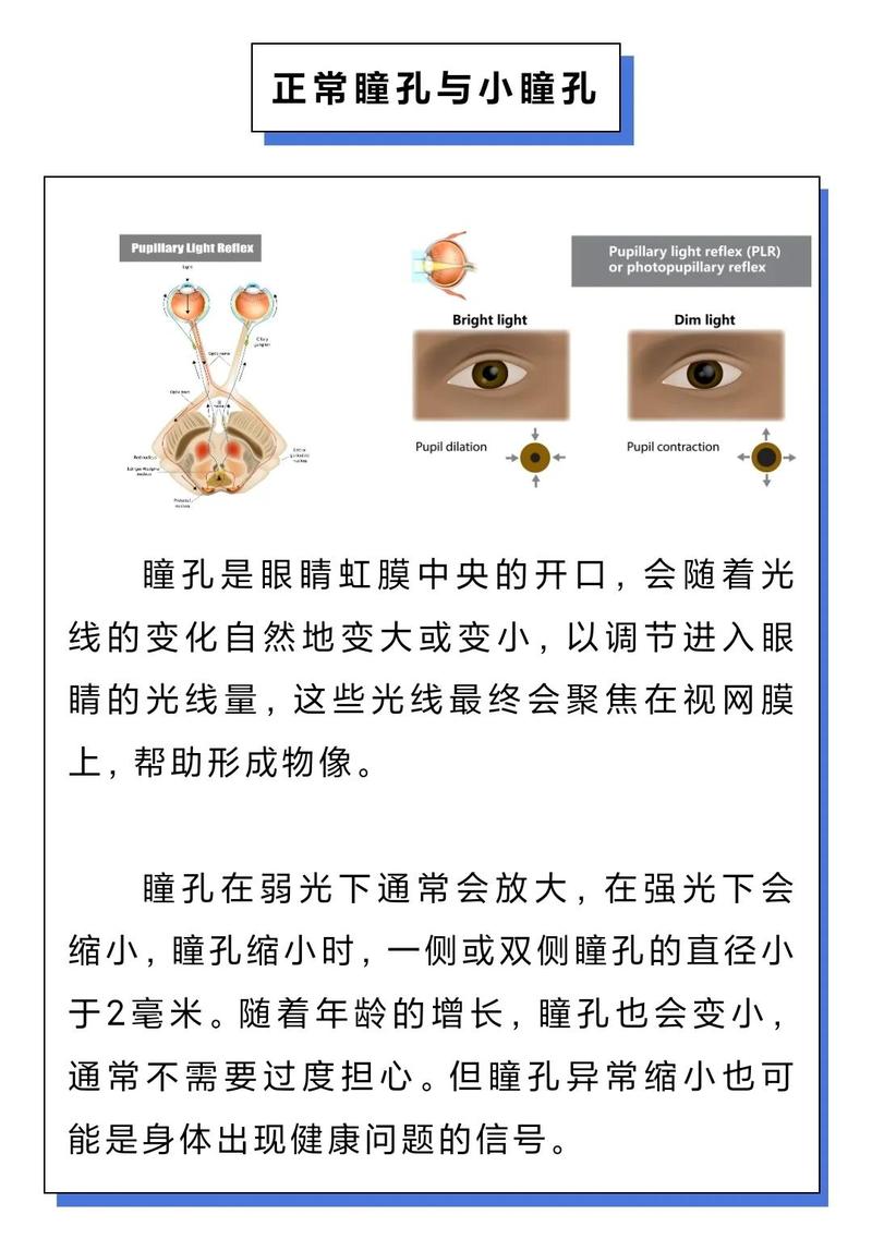 瞳孔遇光不缩小图标