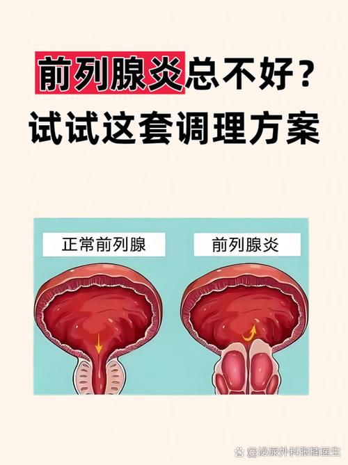 前列腺炎会不会尿频截图