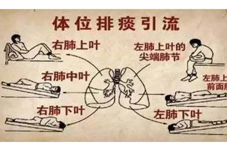 吃什么可以把痰排干净图标