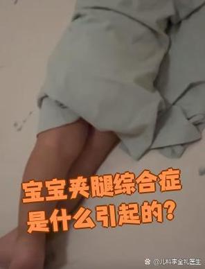 宝宝夹腿综合症是什么症状图标