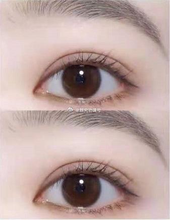 双眼皮图标