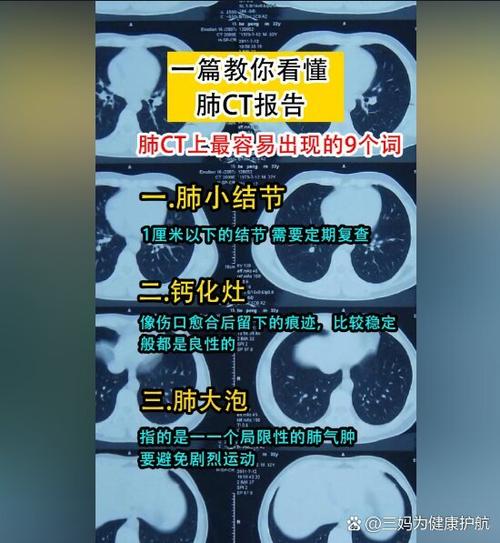 ct片怎么弄成电子版图标