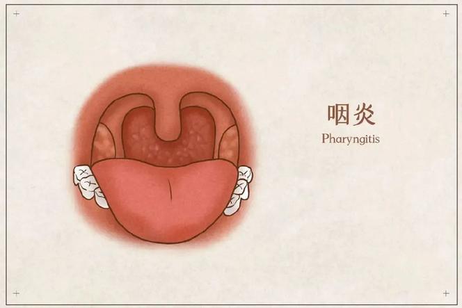 嗓子经常失声截图