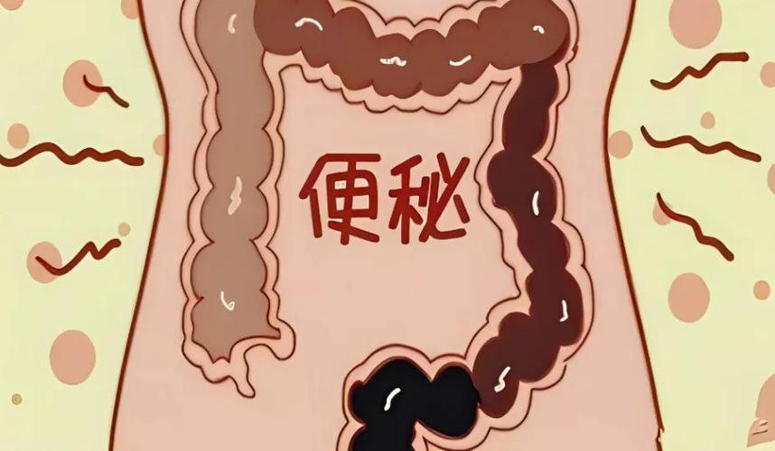 光吃不排便是怎么回事图标