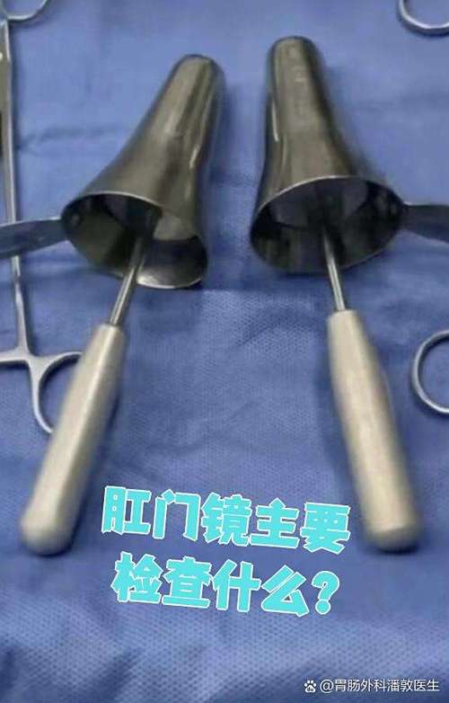 肛门镜检查能查出什么