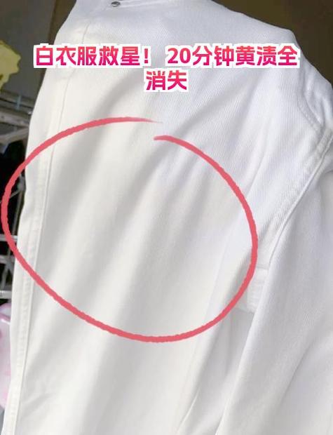 漂白水把衣服漂黄了怎么拯救图标