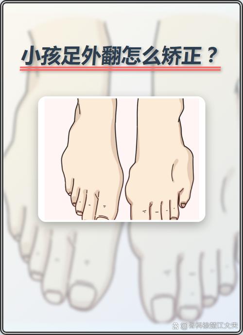 鞋底往外侧倾斜怎么办截图