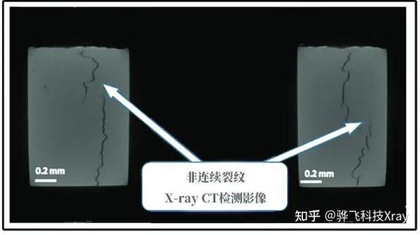 Xray和CT有什么区别缩略图