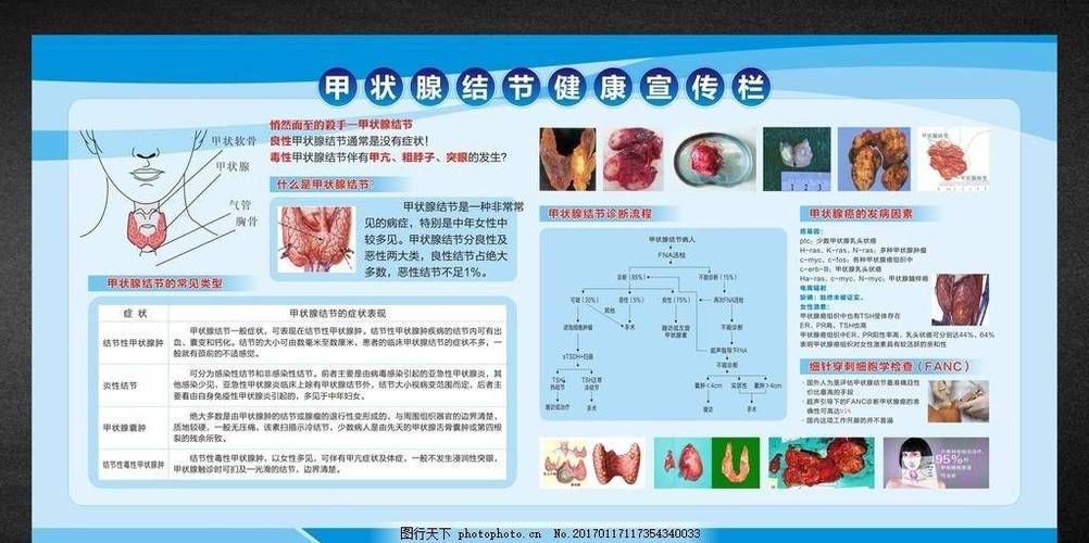 甲状腺结节要注意哪些方面图标
