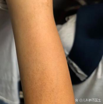 手机氧化斑点怎么处理图标