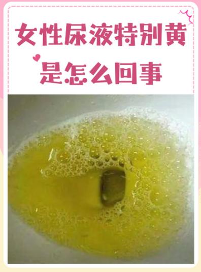 尿液检查尿液少了会不会影响结果图标