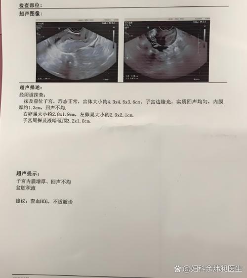 泡状暗区图标