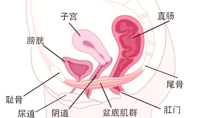 女人盆底肌松弛怎么修复