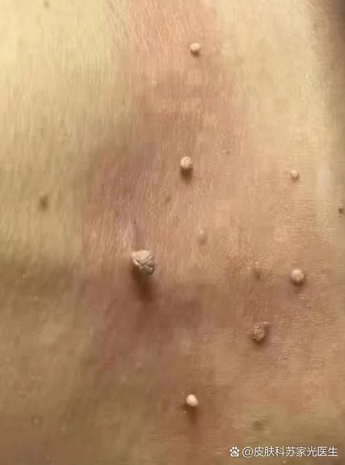 猪肉切开有红色肉疙瘩图标